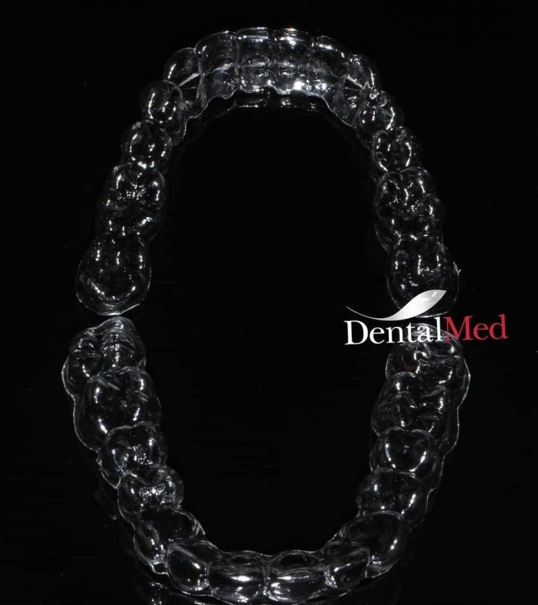 Aparat dentar invizibil INVISALIGN sau SPARK ALIGNER