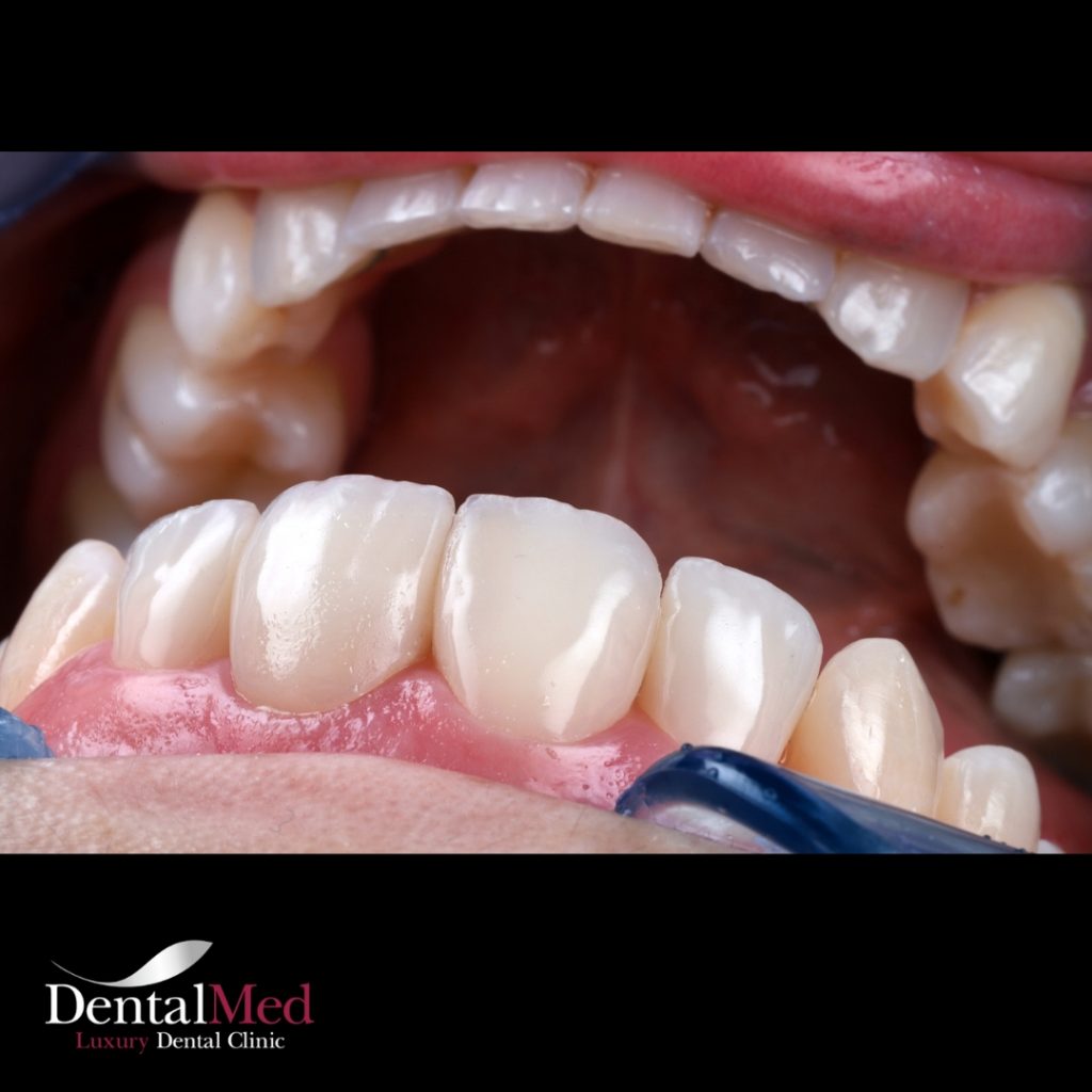 DentalMed | Clinica Stomatologica Bucuresti ⭐ 50 medici dentisti