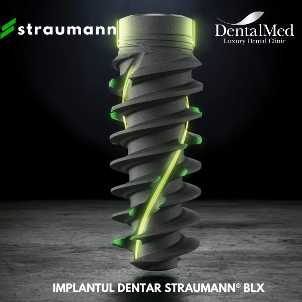 Implant Straumann BLX - cel mai nou implant Straumann